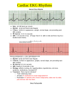 Cardiac EKG Rhythms - DocMerit