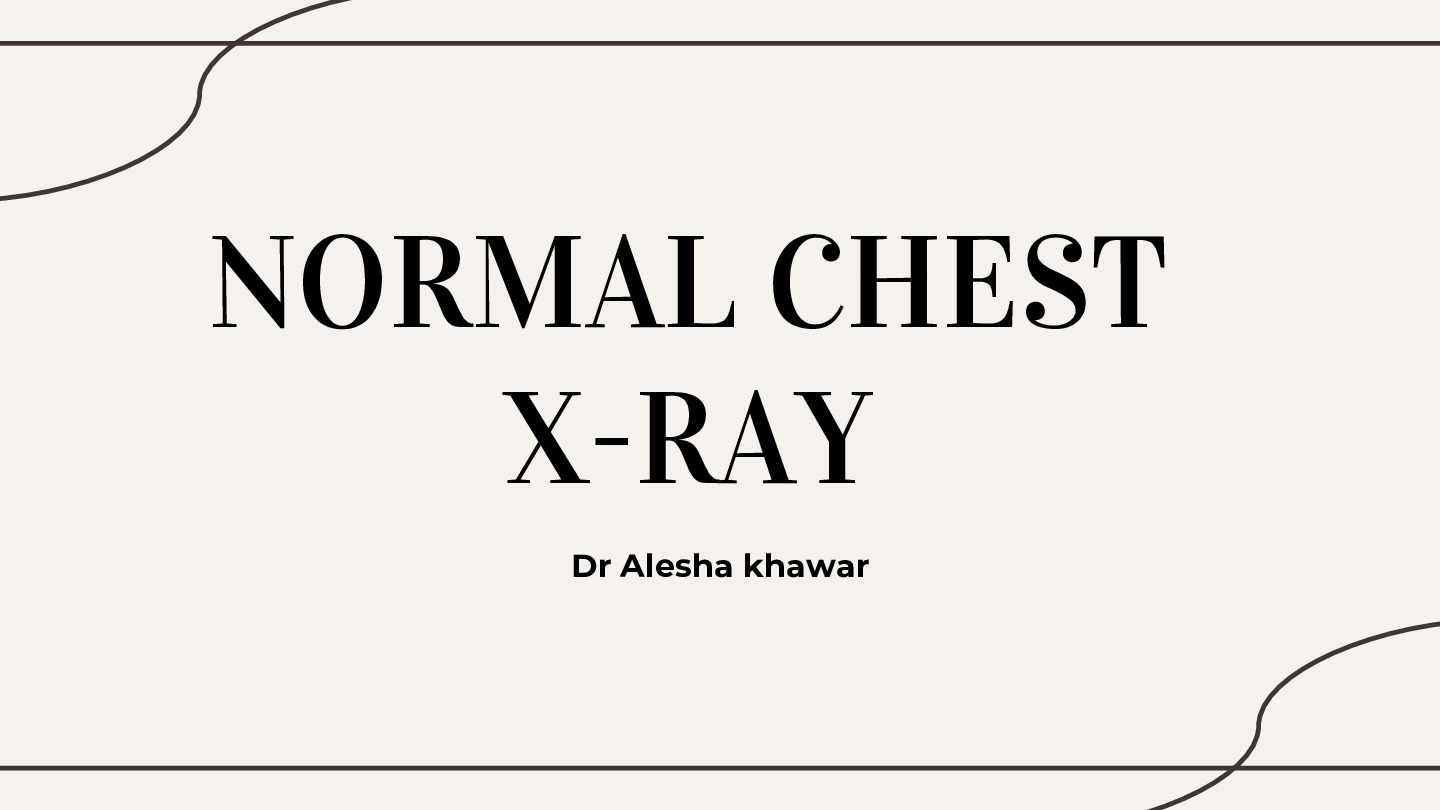 Normal and abnormal chest xray - DocMerit