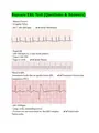 Baycare EKG Test (Questions and Answers) - DocMerit