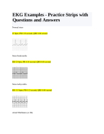 EKG Examples - Practice Strips with Questions and Answers. - DocMerit