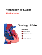 Tetralogy of fallot and stroke - DocMerit