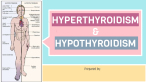 Hyperthyroidism: Nursing Care Plan and Management - DocMerit