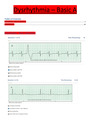 Relias Dysrhythmia Basic - DocMerit