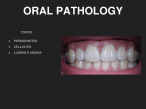 Periodontitis, Cellulitis & Ludwig’s Angina | Oral Pathology Notes ...