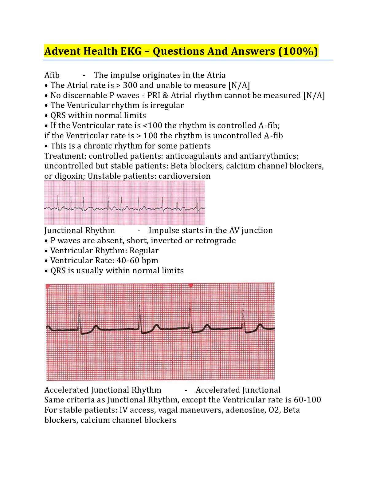 Advent Health EKG – Questions And Answers (100%) - DocMerit