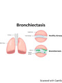 COMPLETE NOTES ON BRONCHIECTASIS WITH SUPPORTIVE DIAGRAMS. - DocMerit