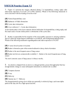 NMTCB Practice Exam V1- V2 (LATEST 2025 - 2026) | QUESTIONS & VERIFIED ...