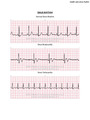 EKG strips SINUS RHYTHM - DocMerit