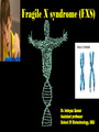 Fragile X syndrome disease - DocMerit