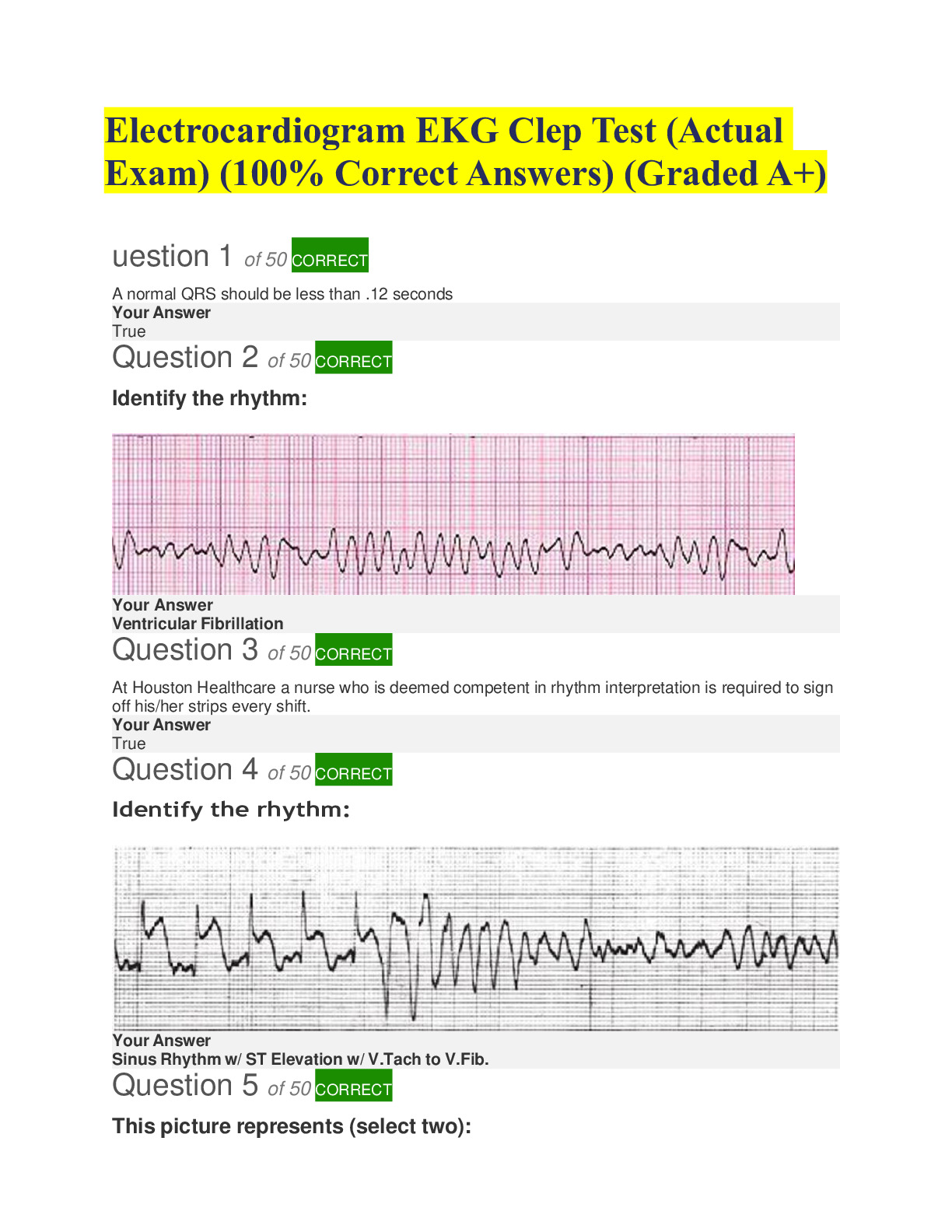 Electrocardiogram EKG Clep Test (Actual Exam) (100% Correct Answers ...